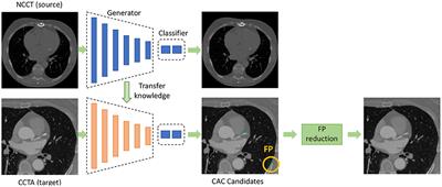 Frontiers | Learning coronary artery calcium scoring in coronary CTA from non-contrast CT using ...